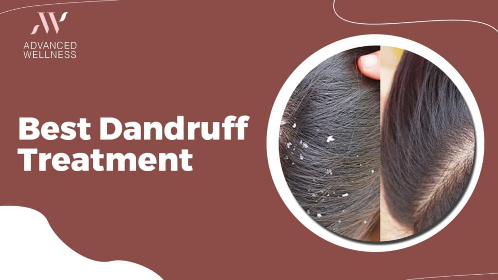 Best Dandruff Treatment | Laser Hair Removal In Ghaziabad